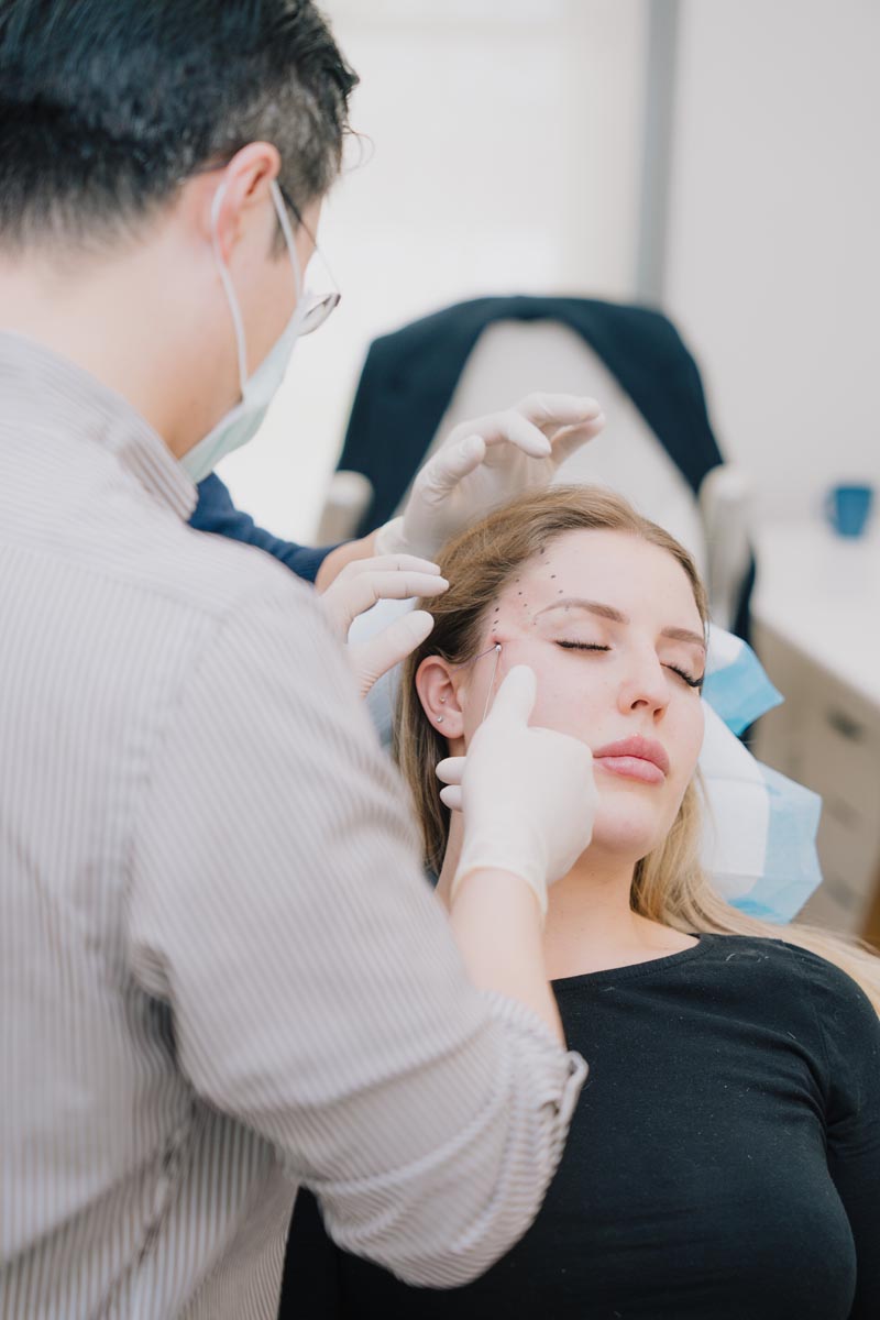 Thread Lift Perth | PDO Non-Surgical Face & Eyebrow Lift