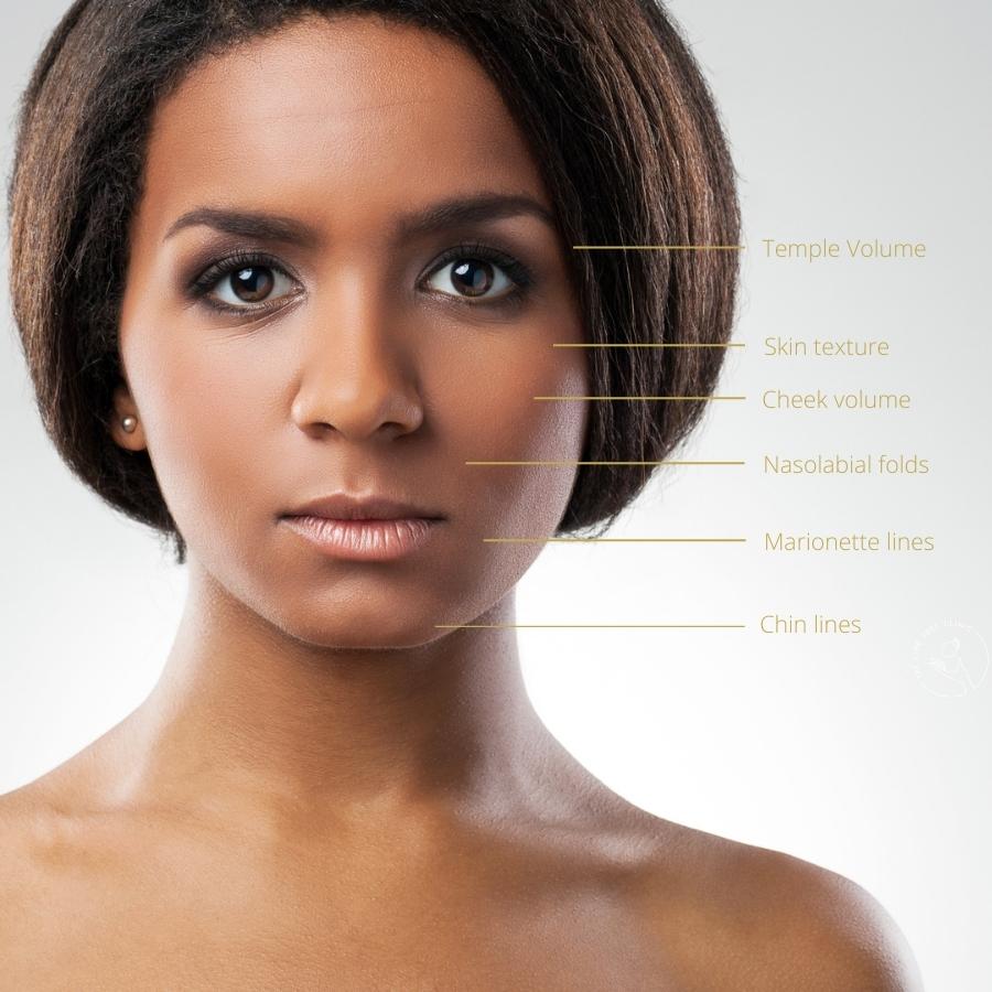 Collagen Stimulator Injections Perth | Induction Therapy