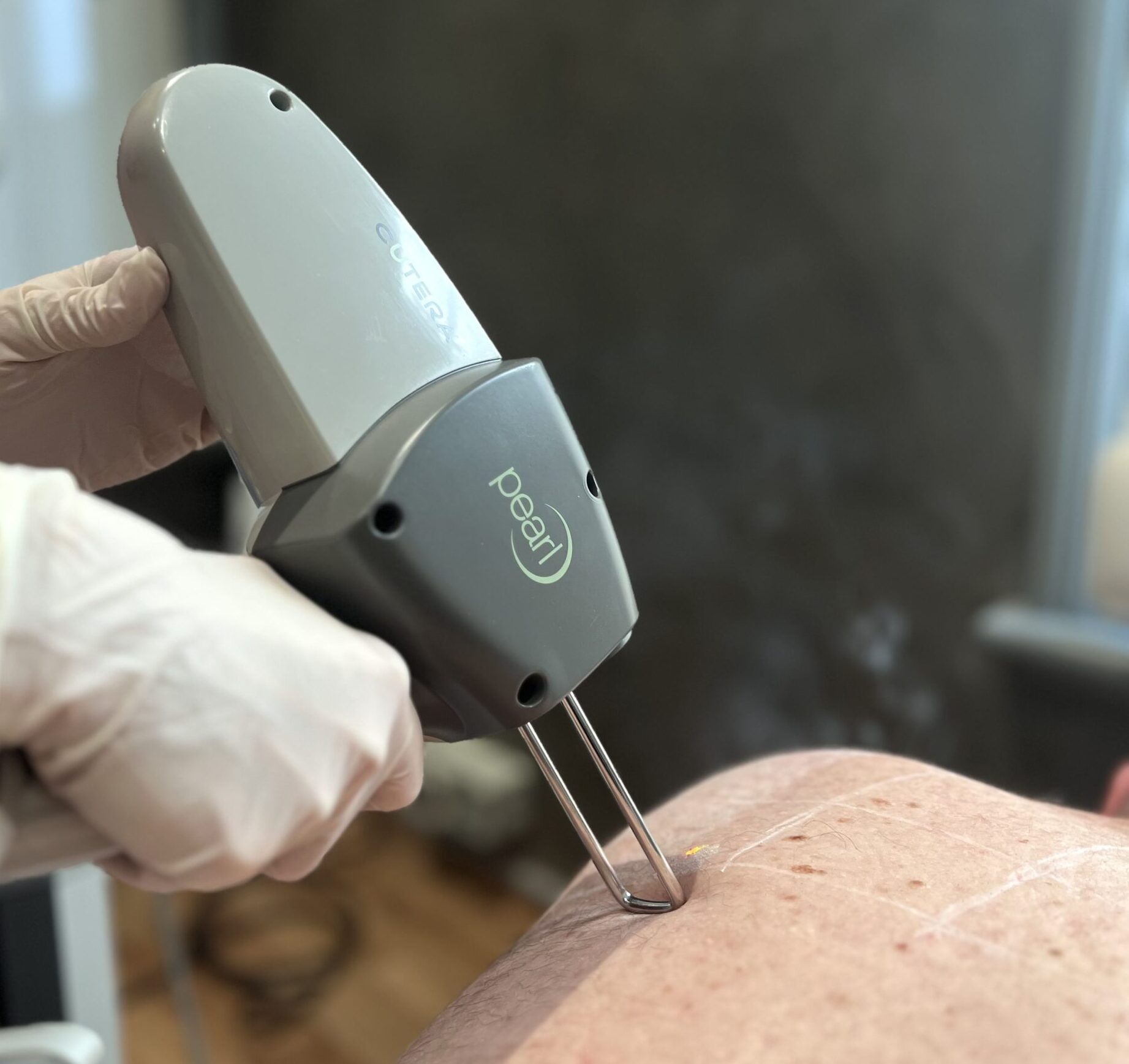 Treatment packages | The Lime Tree Clinic